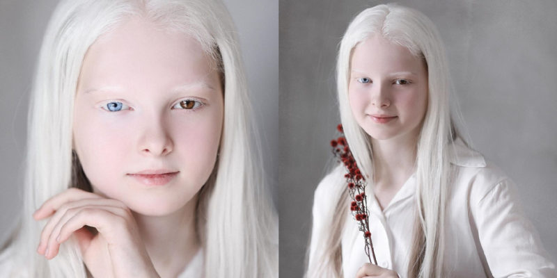 Lernen Sie eine der schönsten und einzigartigsten Albinos der Welt ...